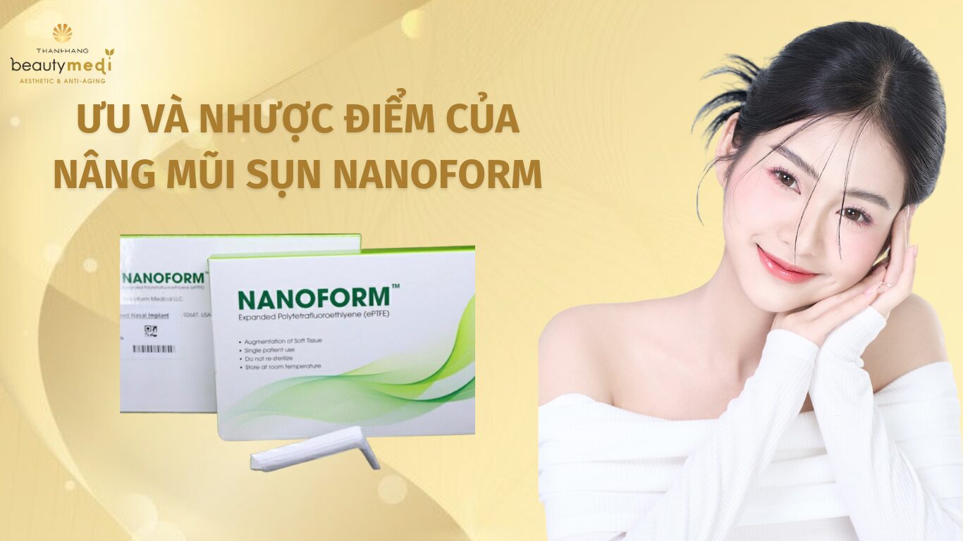 » Các loại sụn nâng mũi phổ biến, tốt nhất 2024 – Ưu nhược điểm từng loại